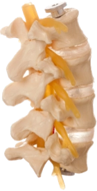 Spondylolisthesis | Wascher Spine Institute